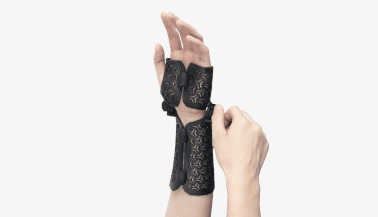 3D Printed Orthotics and Prosthetics - HeyGears