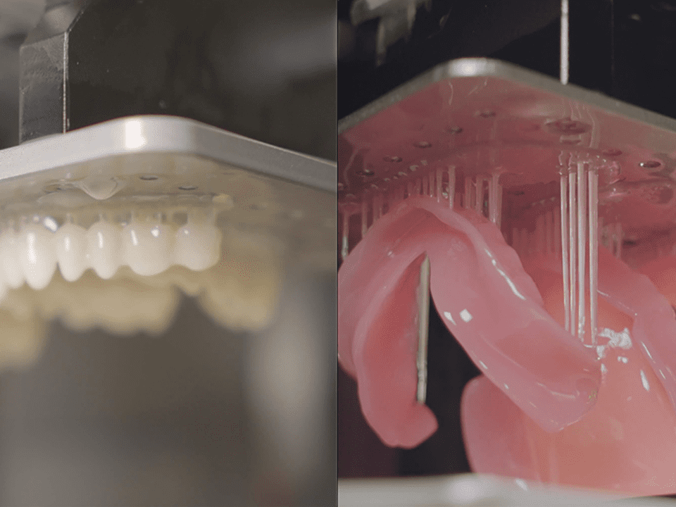 Digital Denture Teeth Solution - HeyGears