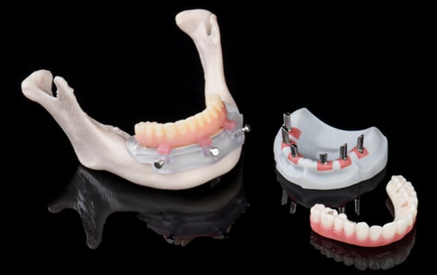 Impression Scan Solution - HeyGears